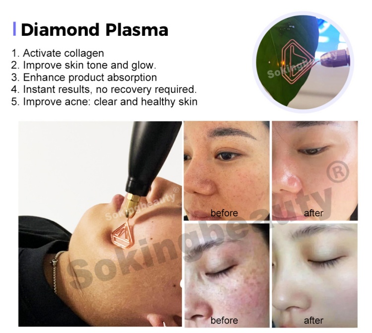 Anti Inflammatory Wrinkle Removal Multi Function 9 In 1 Dual Control ...