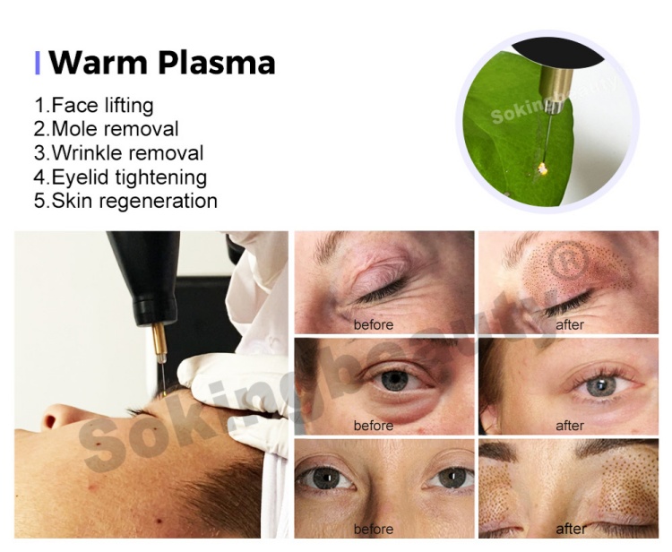 Anti Inflammatory Wrinkle Removal Multi Function 9 In 1 Dual Control ...